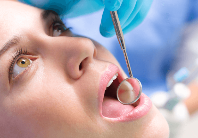 Different Types Of Dental Cavities And How To Remove Them? - ComptonHerald